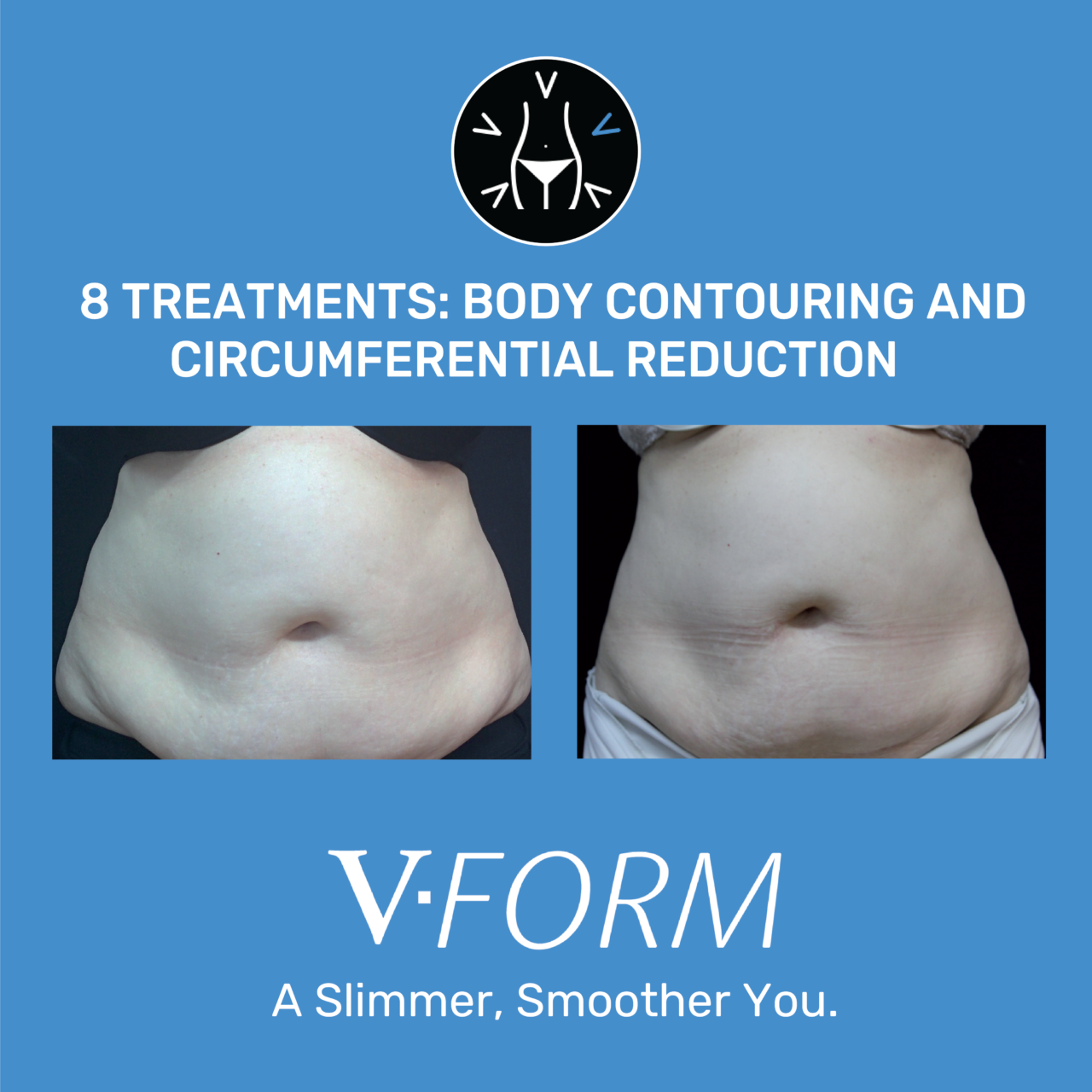 VIORA LASER | Fig Medical Spa