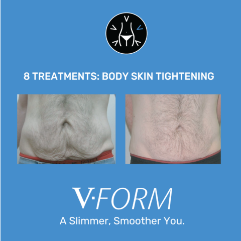 VIORA LASER | Fig Medical Spa