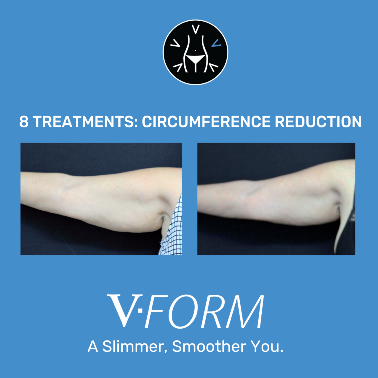 VIORA LASER | Fig Medical Spa