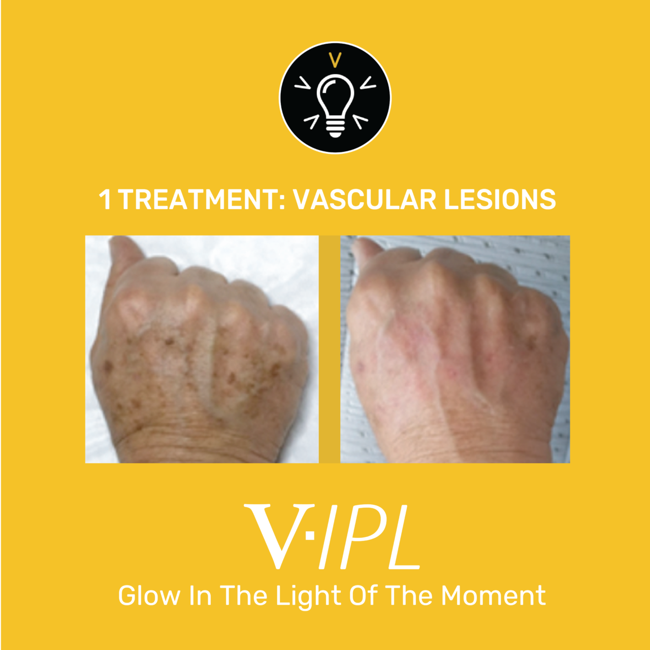 VIORA LASER | Fig Medical Spa