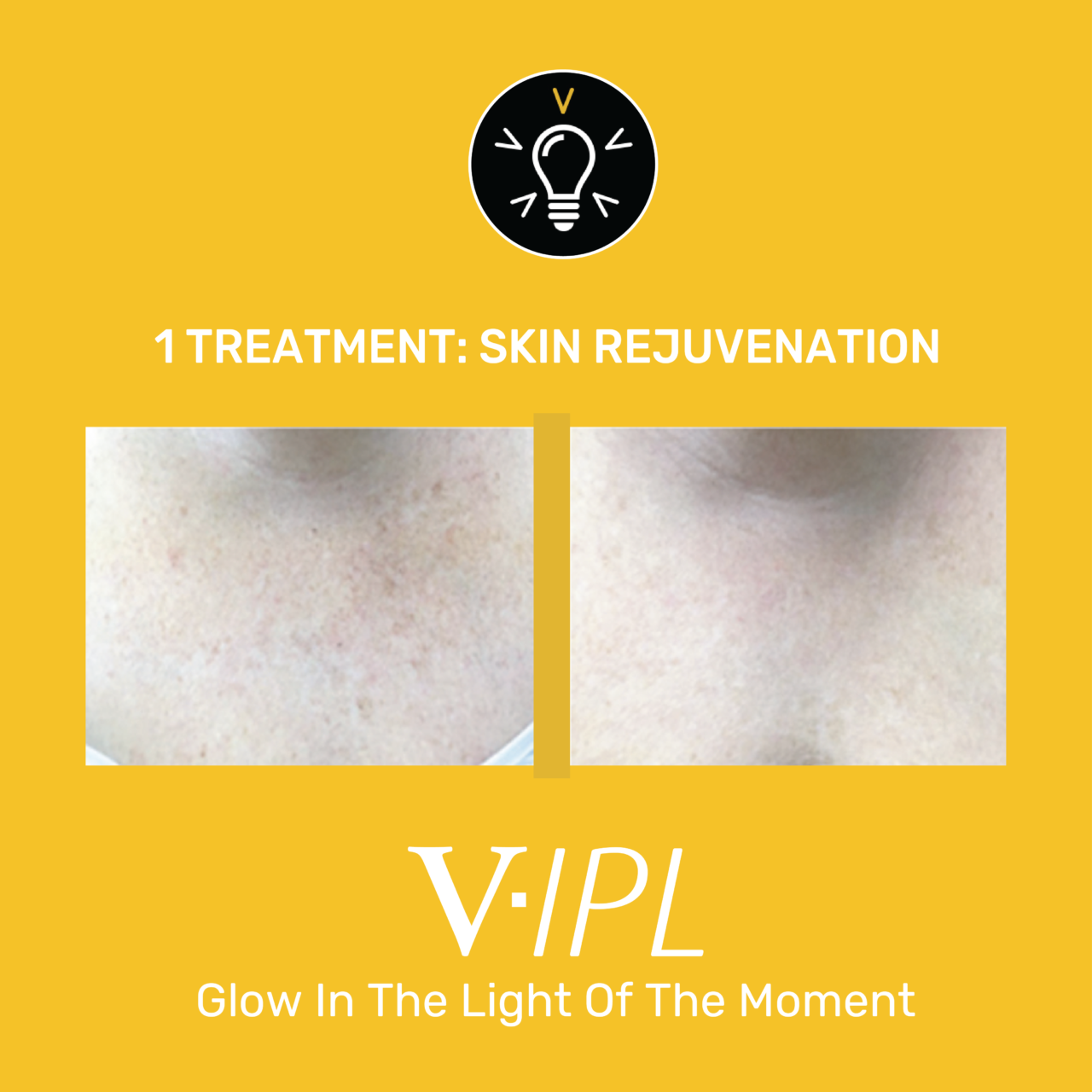 VIORA LASER | Fig Medical Spa