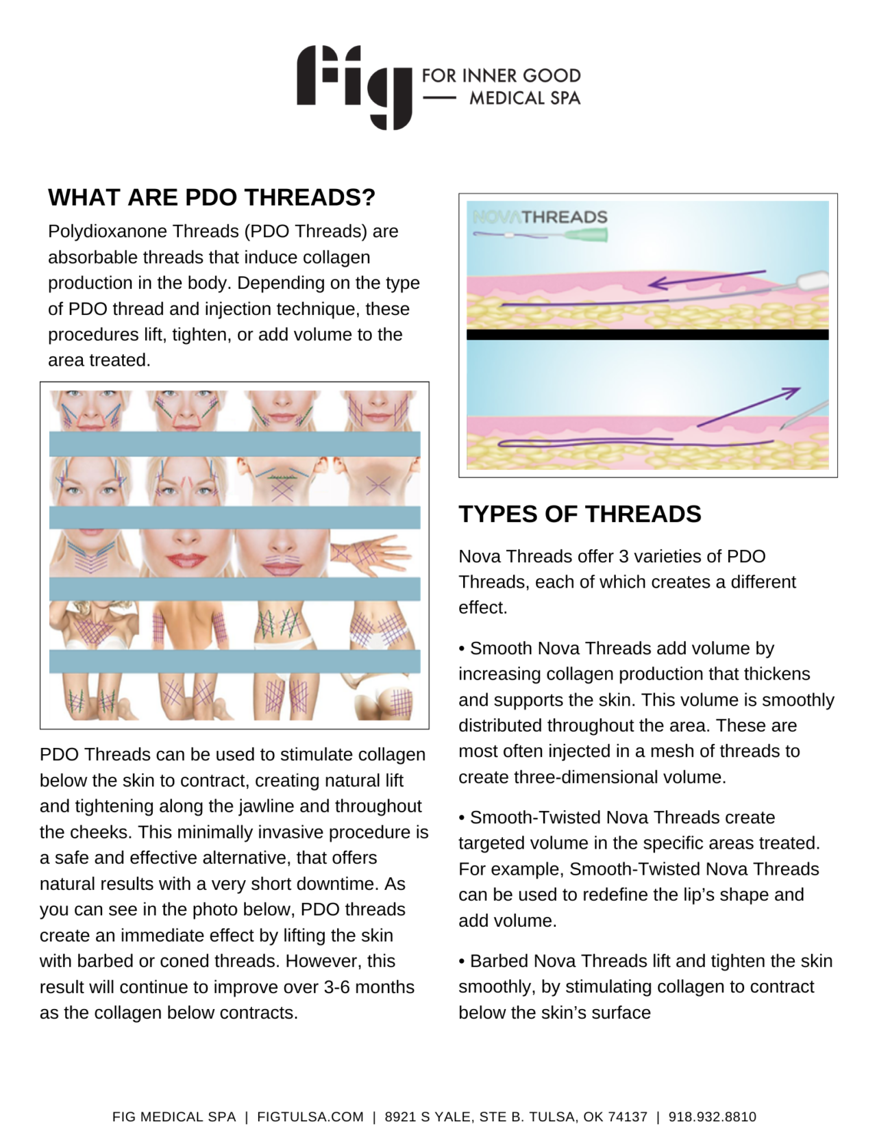 PDO THREADS | Fig Medical Spa