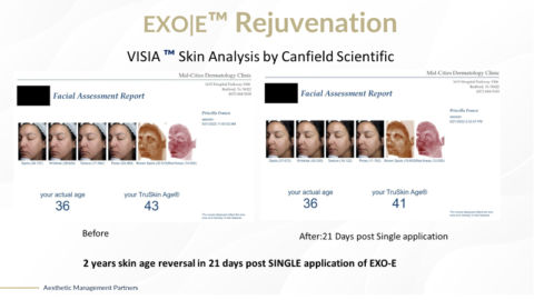 EXOE STEM CELLS | Fig Medical Spa